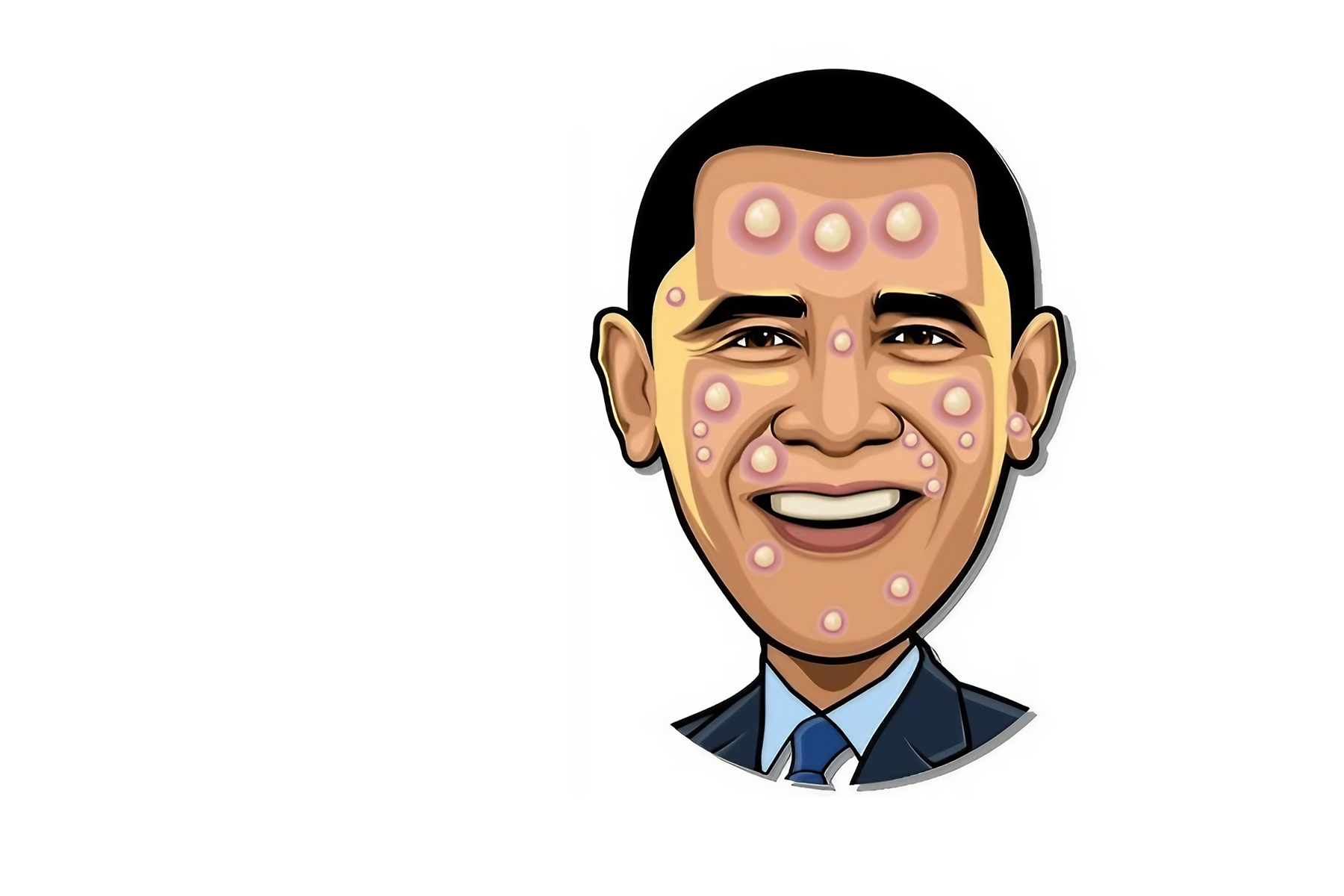 Celebrity Pimple Pop - WGPlayground.com